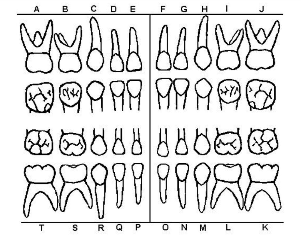 Printable Dental Chart Template